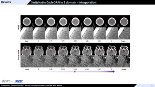 Continuous Conversion of CT Kernel using Switchable CycleGAN with AdaIN ...