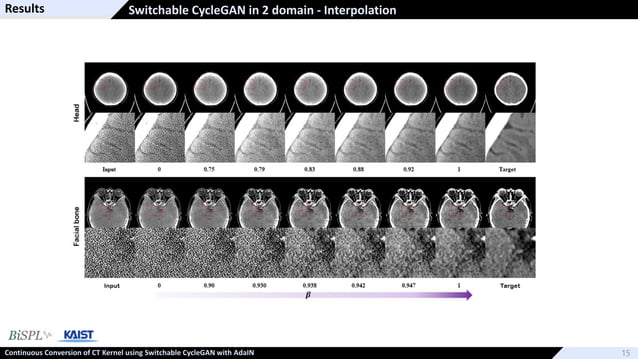 Continuous Conversion of CT Kernel using Switchable CycleGAN with AdaIN ...