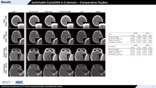 Continuous Conversion of CT Kernel using Switchable CycleGAN with AdaIN ...