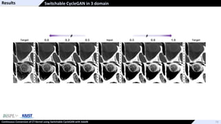 Continuous Conversion of CT Kernel using Switchable CycleGAN with AdaIN ...