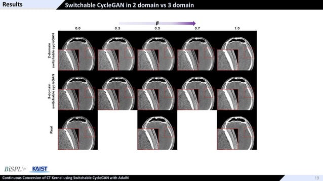 Continuous Conversion of CT Kernel using Switchable CycleGAN with AdaIN ...