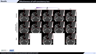 Continuous Conversion of CT Kernel using Switchable CycleGAN with AdaIN | PPT