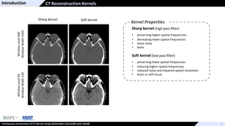 Continuous Conversion of CT Kernel using Switchable CycleGAN with AdaIN ...