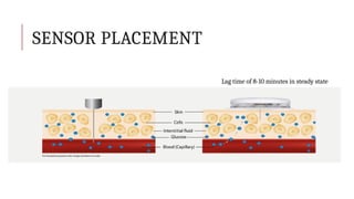 Continuous Glucose Monitoring in children.pptx