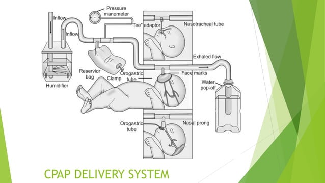Continuous possitive pressure ventilation (cpap) | PPTX