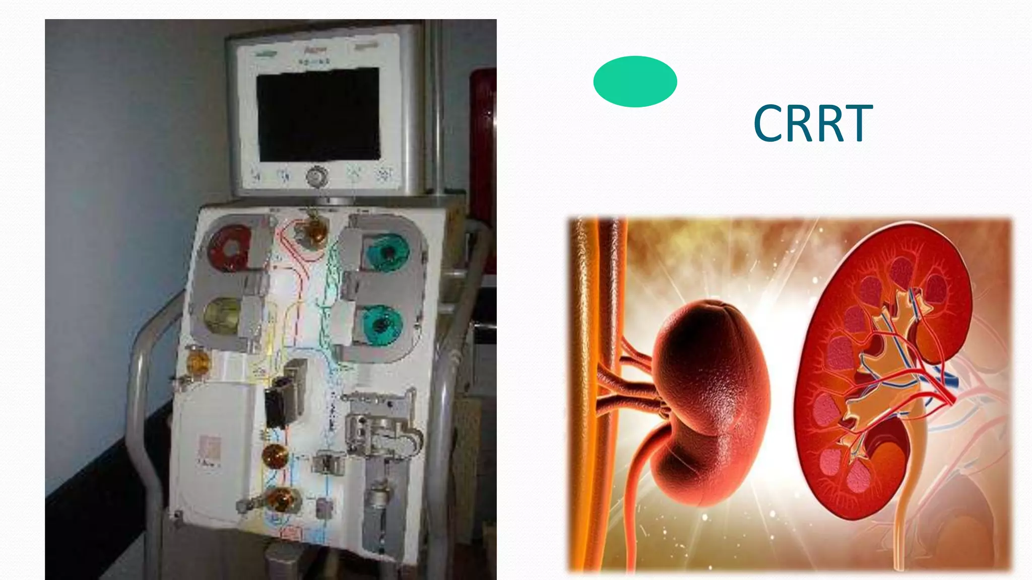 Continuous renal replacement therapy crrt | PPTX