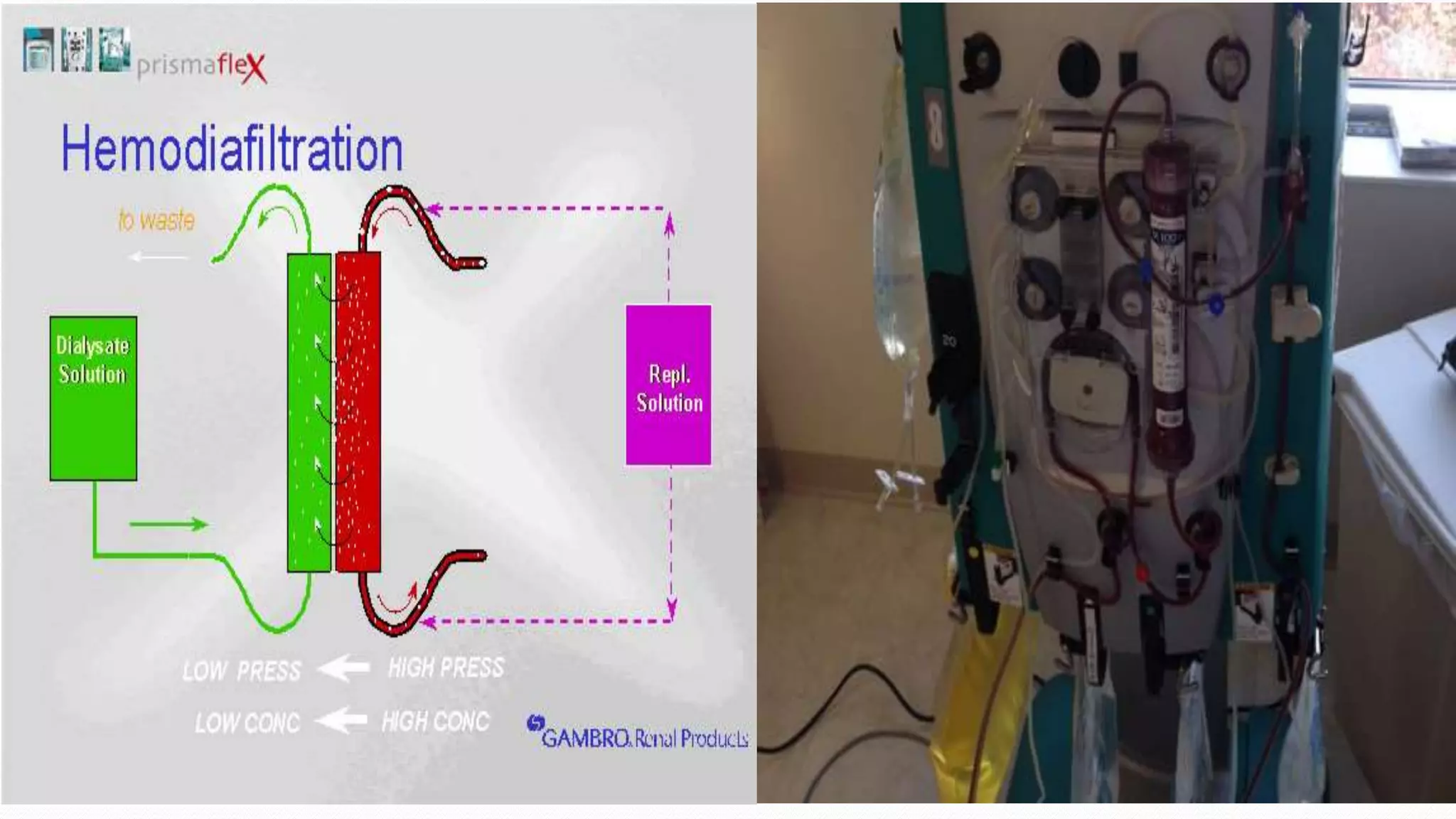 Continuous renal replacement therapy crrt | PPTX