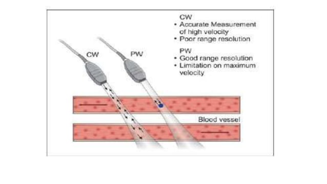 Continuous Wave and Pulsed Wave.pptx | Physics | Science