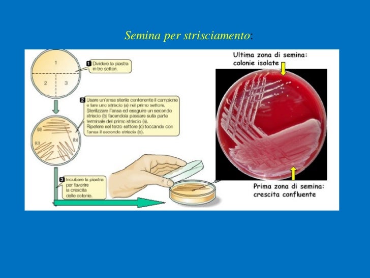 Contaminazione microbiologica