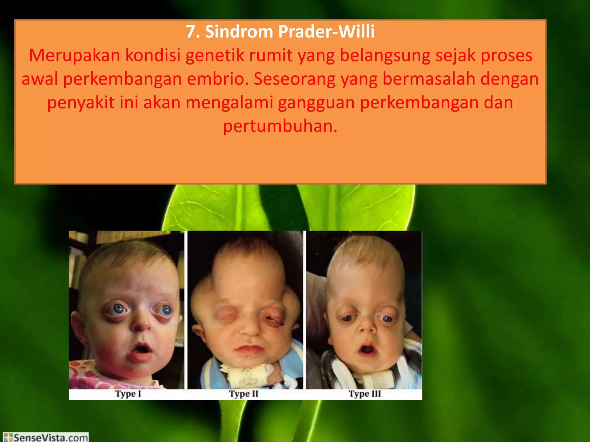 Contoh contoh mutasi (gezan girya noor, m. rizki w.r, & rahmadhana .m ...