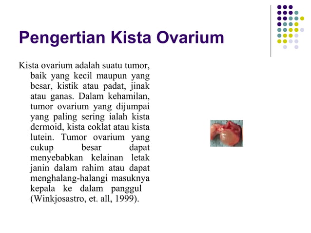 Contoh kista ovarium | PPT