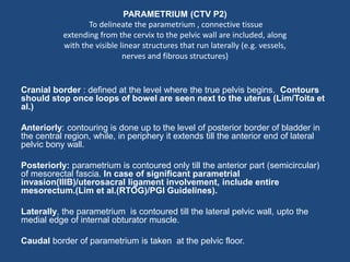 Contouring guidelines Cervix IMRT | PPTX