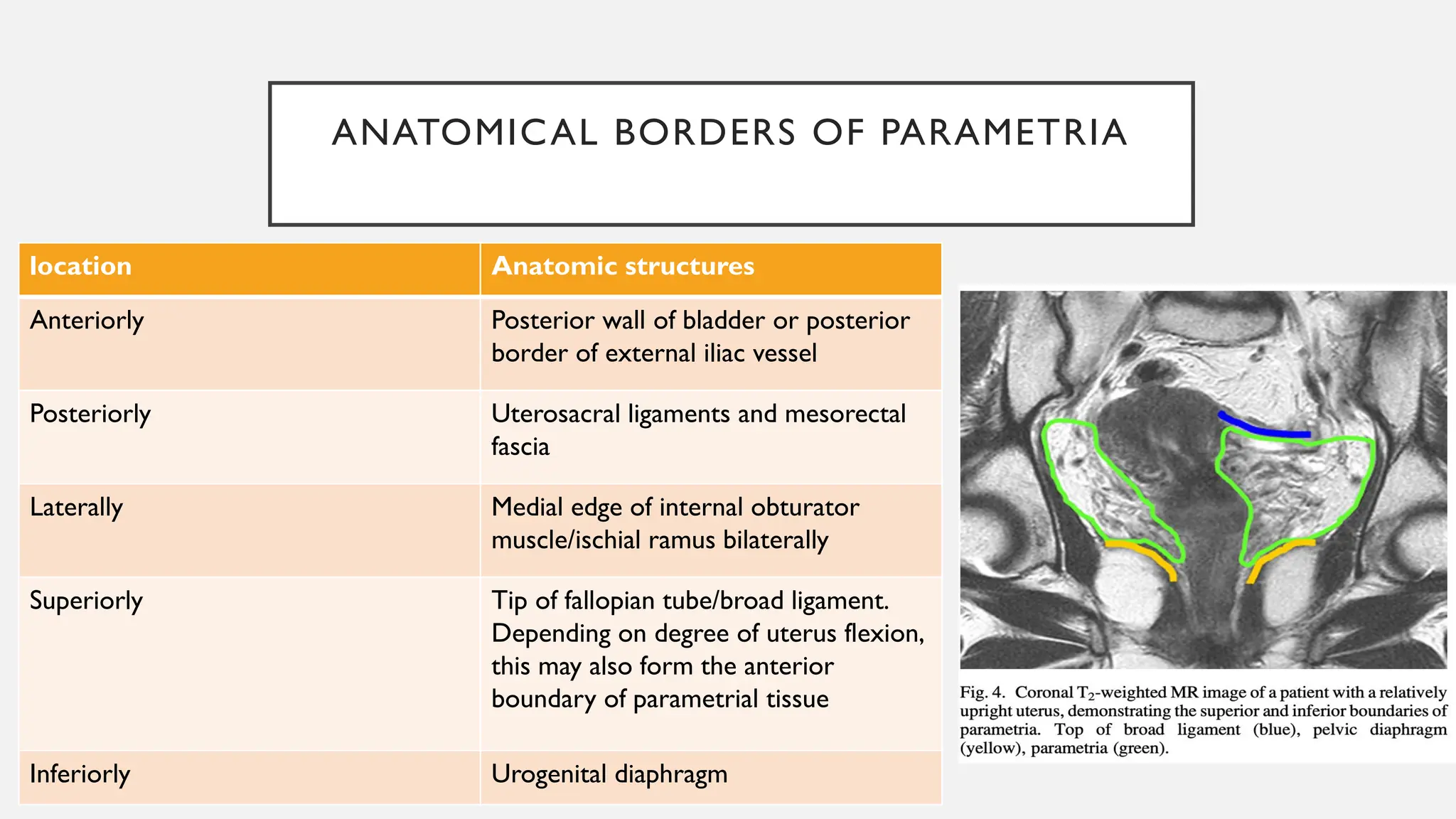 contouring guidelines ca cervix.pdf