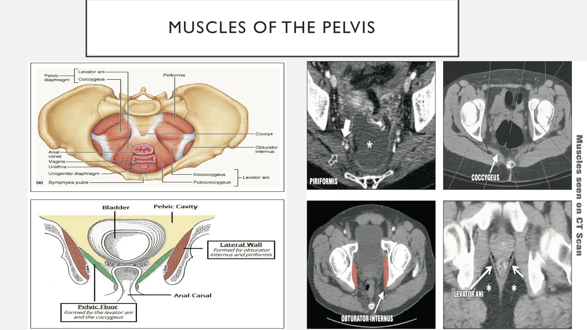 contouring guidelines ca cervix.pdf