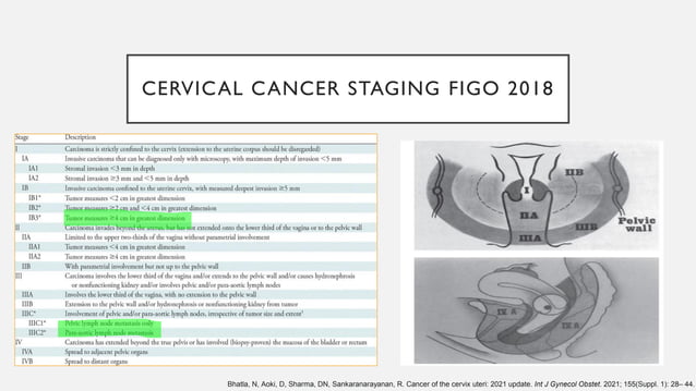 contouring guidelines ca cervix.pdf | Cancer | Diseases and Conditions