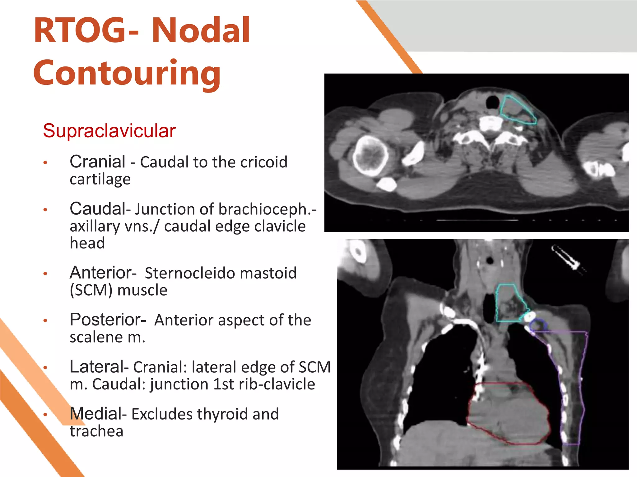 Contouring in breast cancer current practice and future directions | PPTX