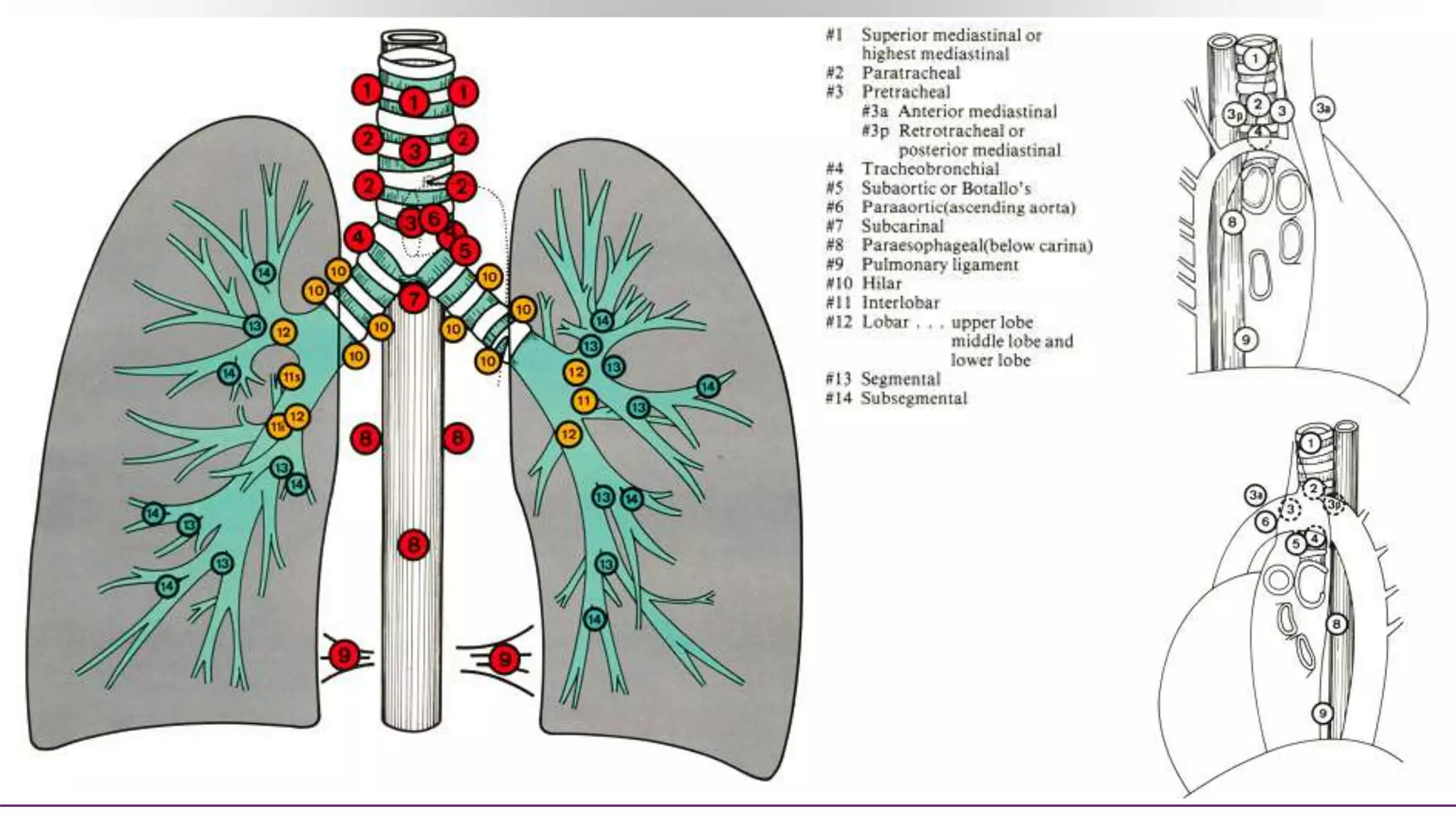Contouring of CTV lymph nodes in NSCLC (Part I) | PPTX