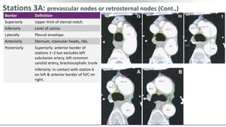 Contouring of CTV lymph nodes in NSCLC (Part I) | PPTX