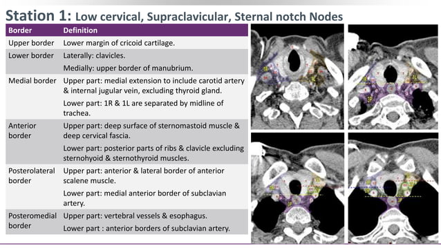 Contouring of CTV Lymph nodes in NSCLC (Part III) | PPT