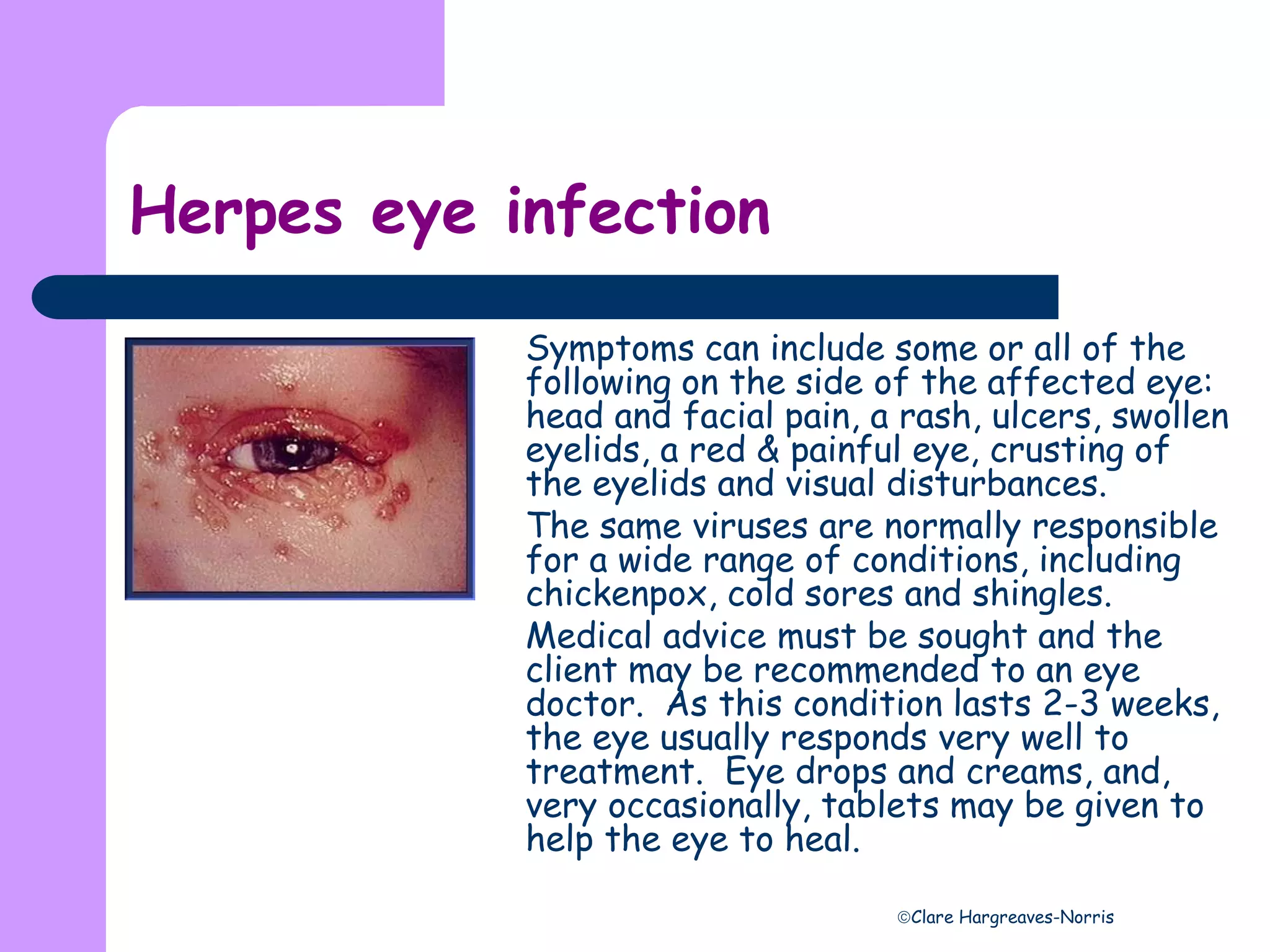 Contra indications | PPTX