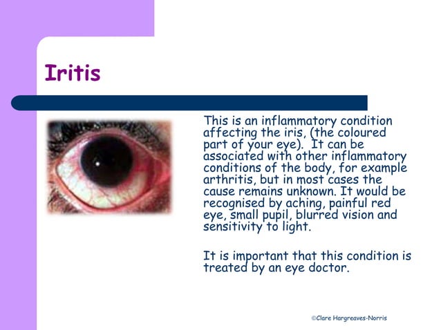 Contra indications | PPTX | Eye and Vision Conditions | Diseases and ...