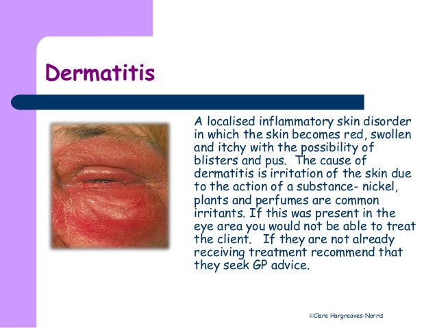 Contraindications To Makeup Services | Saubhaya Makeup