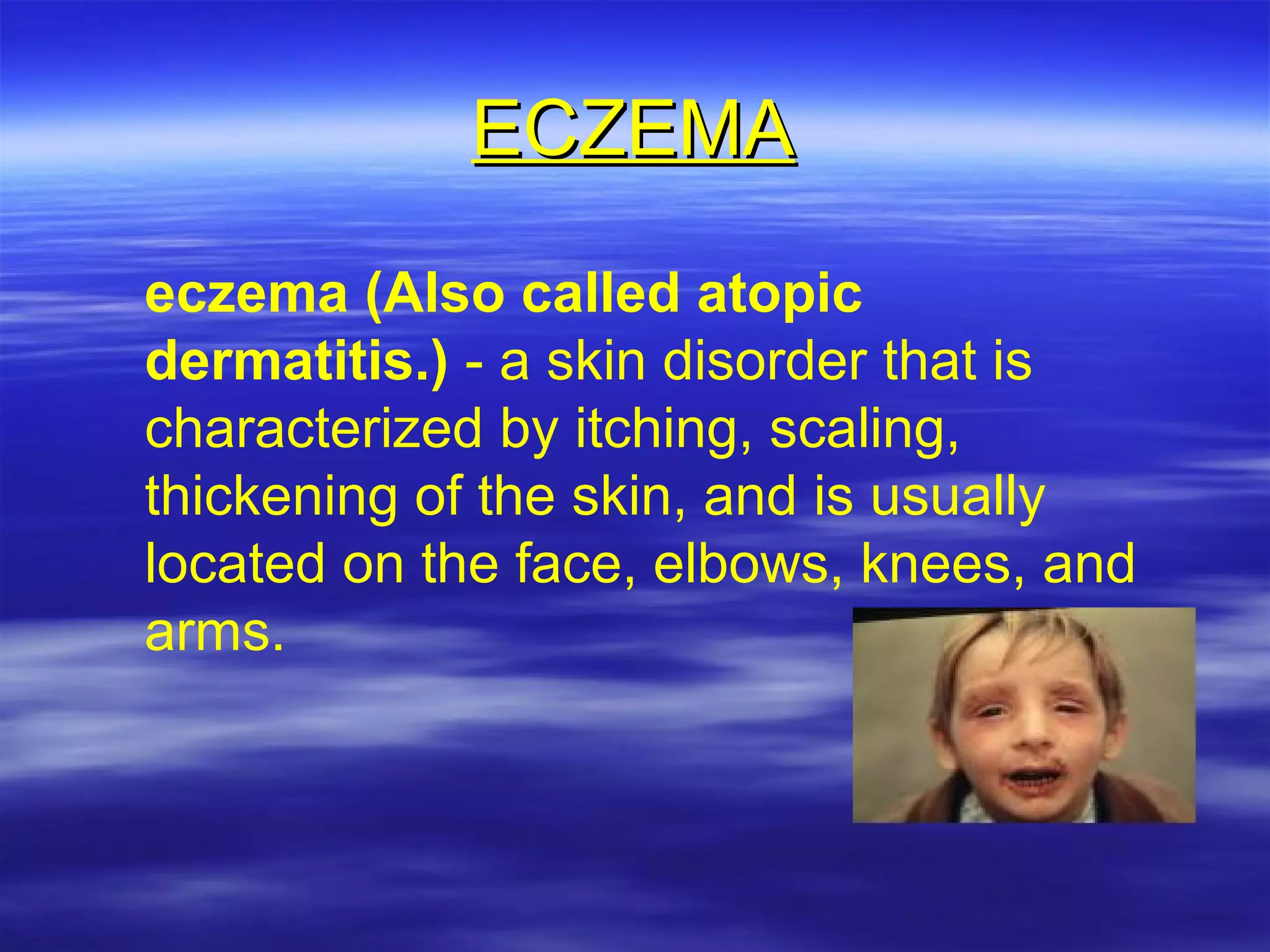 Contra indications to facials | PPT