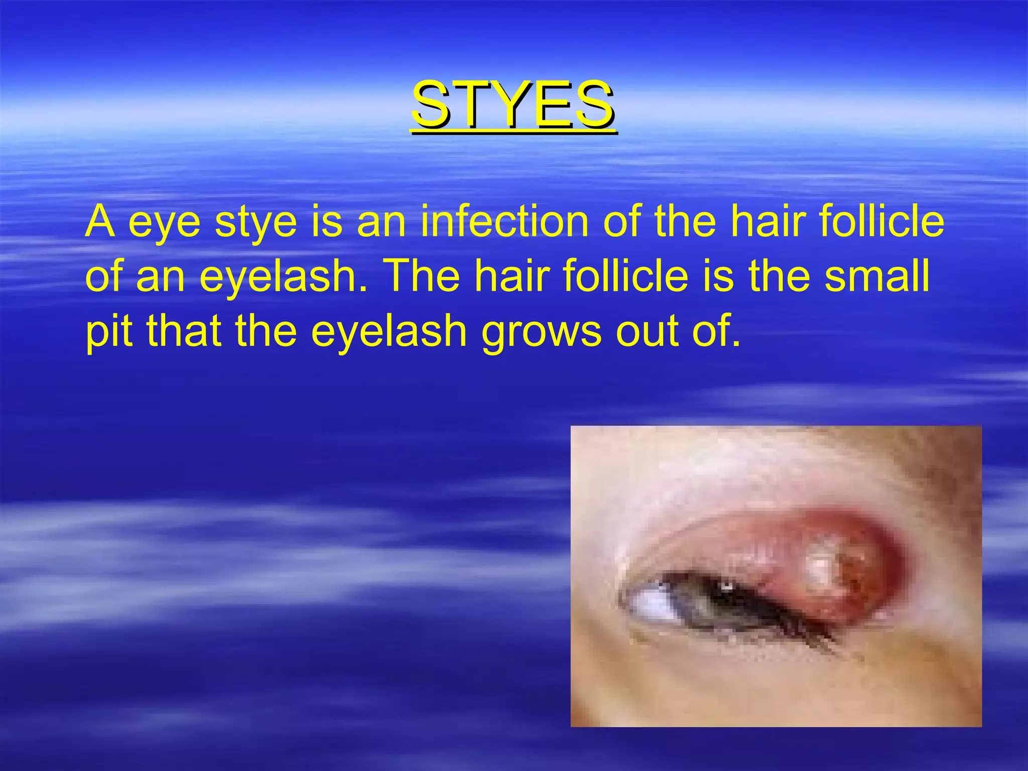 Contra indications to facials | PPT