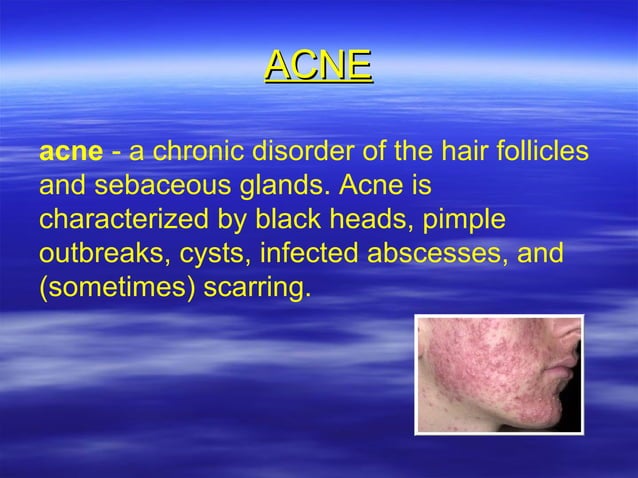 Contra indications to facials | PPT