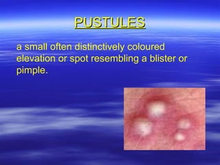 Contra indications to facials | PPT