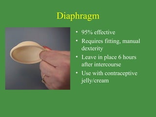 Contraception | PPT