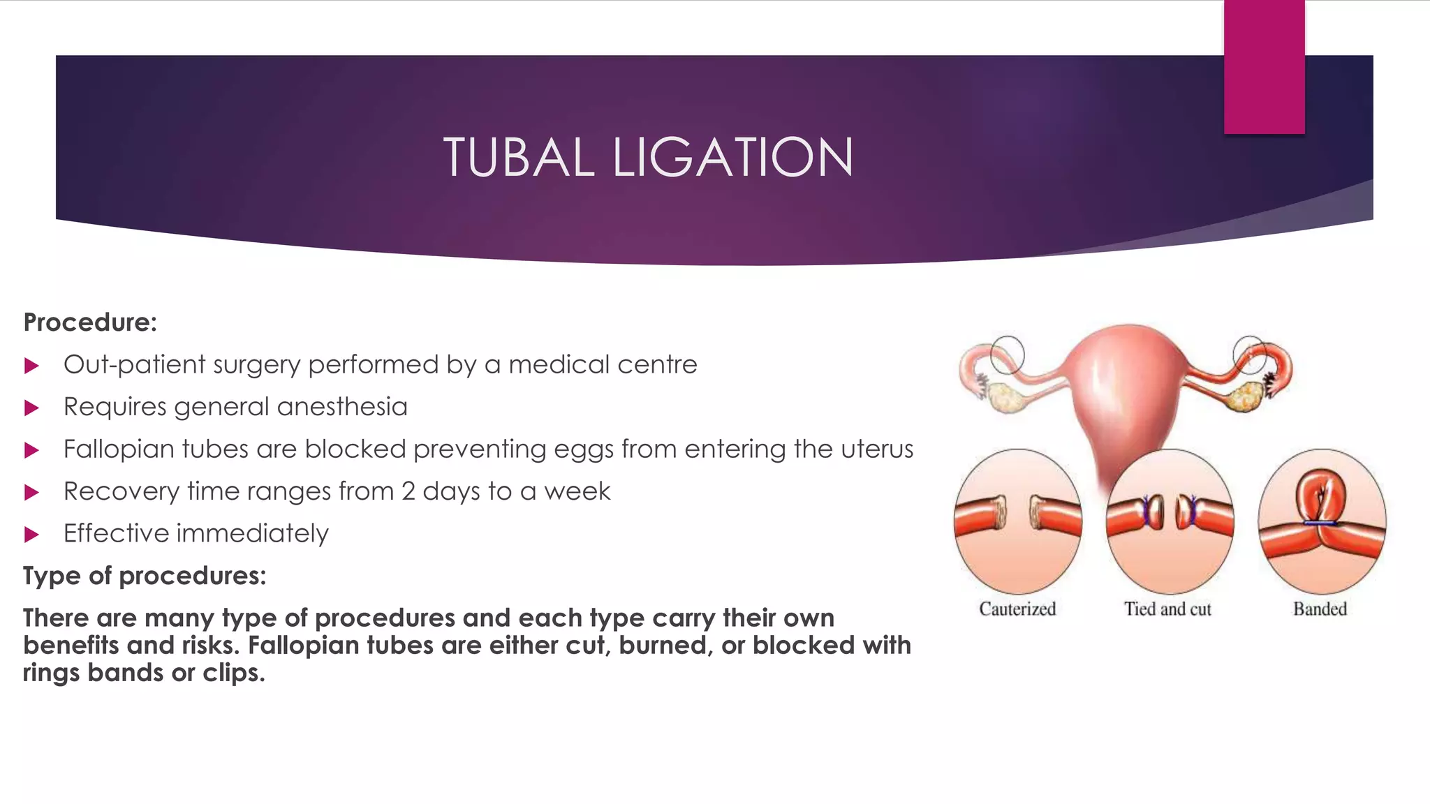 Contraception | PPTX