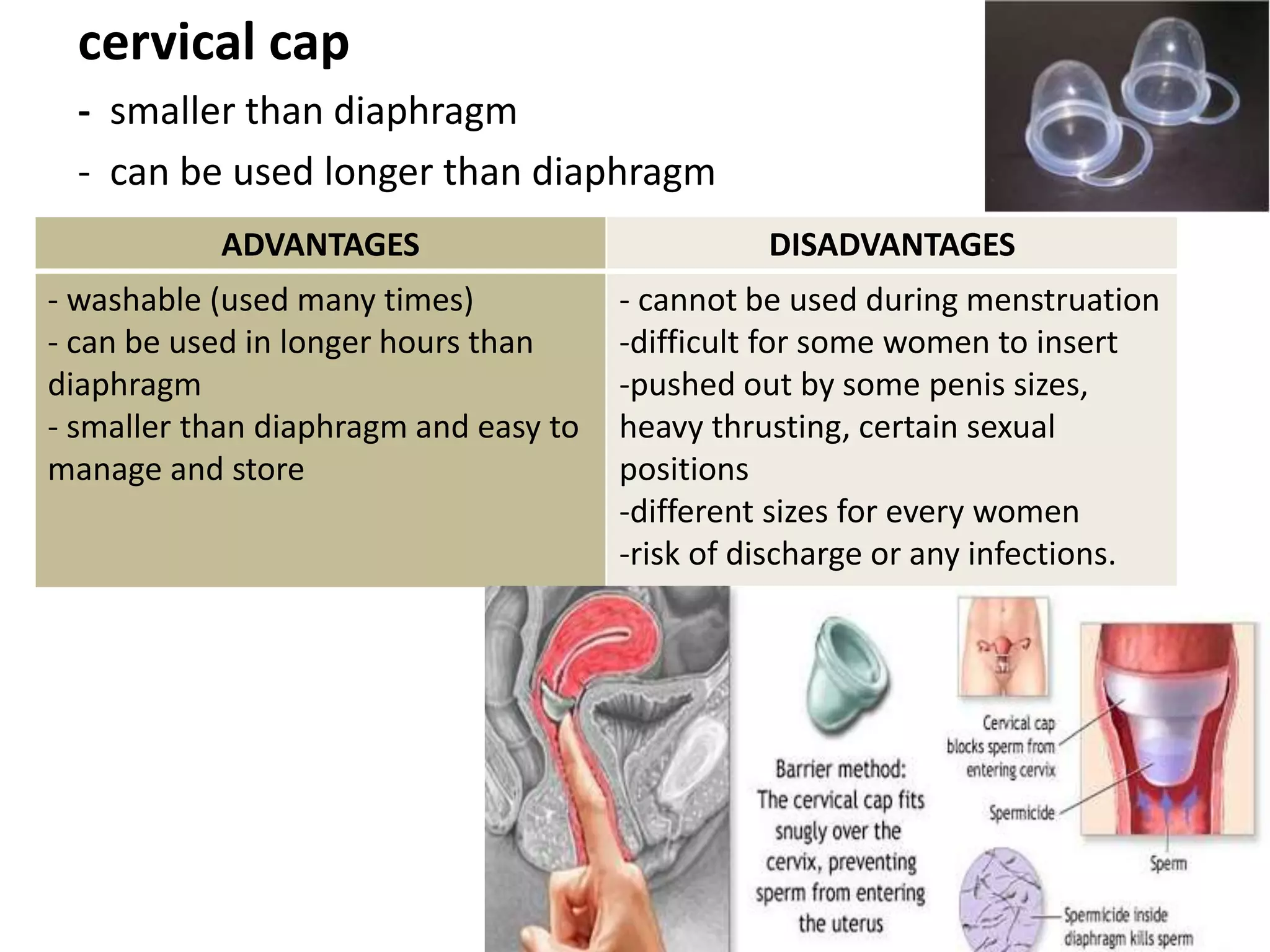 Contraceptive Methods | PDF