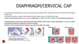 contraception | PPTX