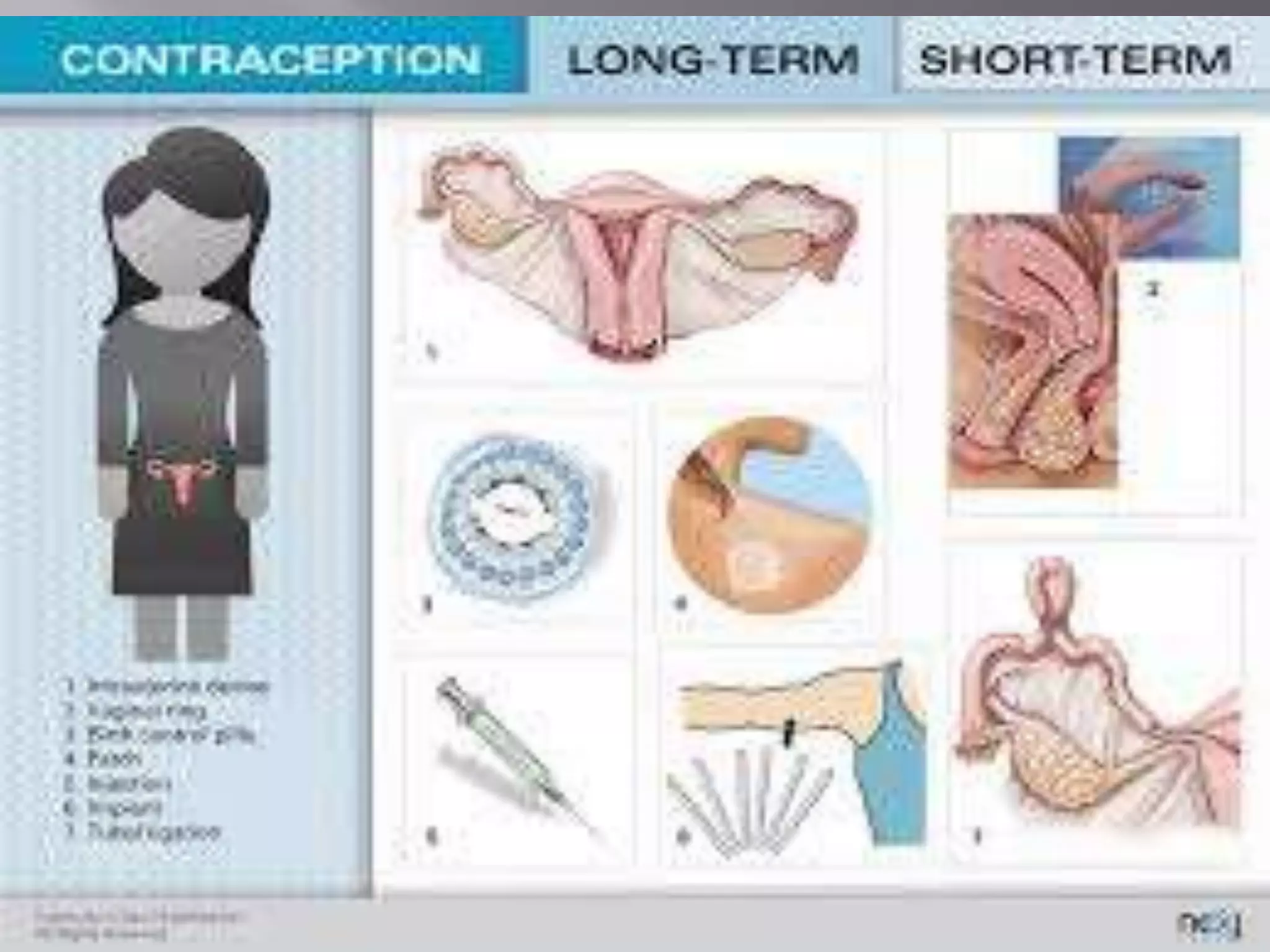 contraception.pptx