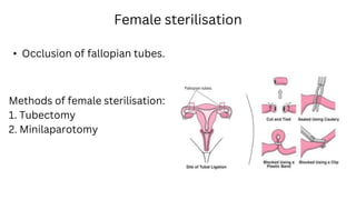 Contraception for protection from pregnancy.pptx