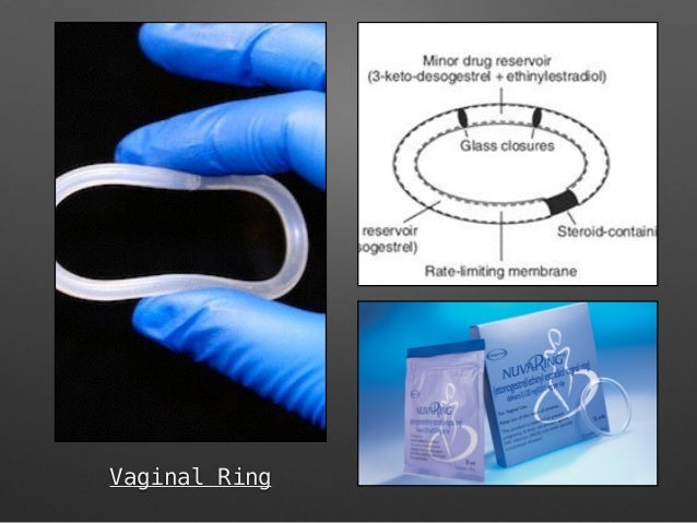 'Contraception' 2014