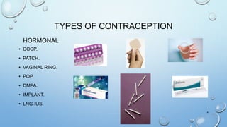 CONTRACEPTION 2.0.pptx