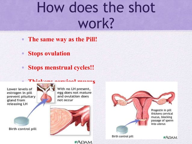 Contraception2022.ppt