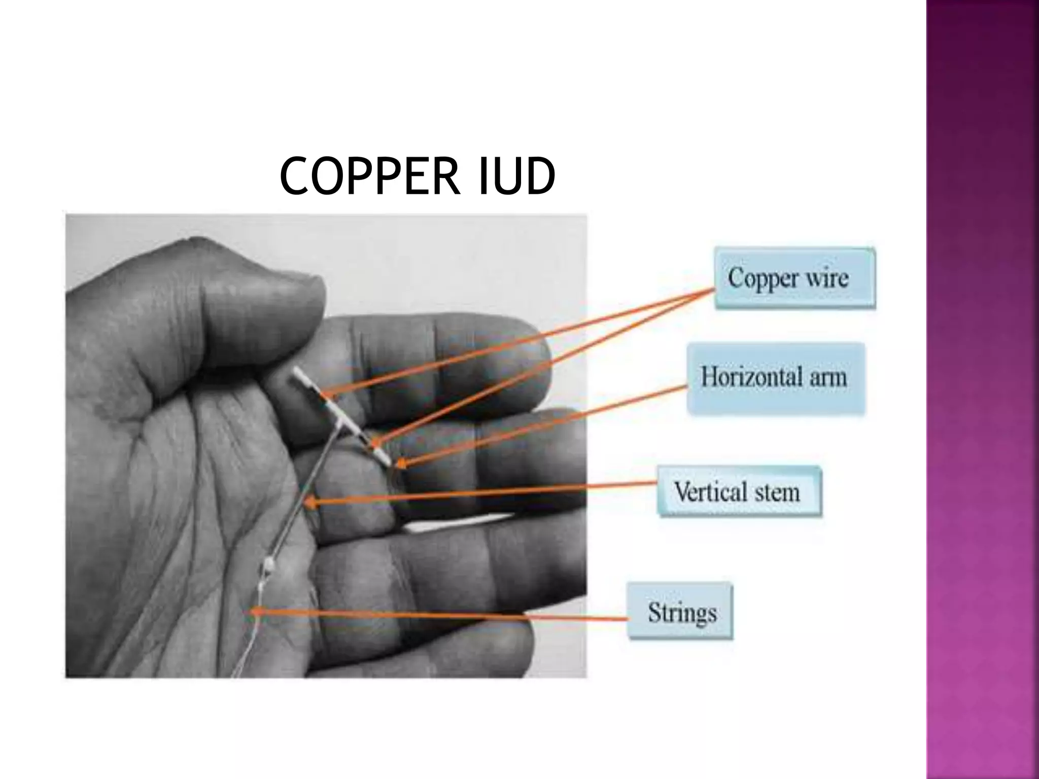 CONTRACEPTION IUCD POWERPOINT | PPTX