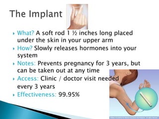 Contraception ppt | PPTX