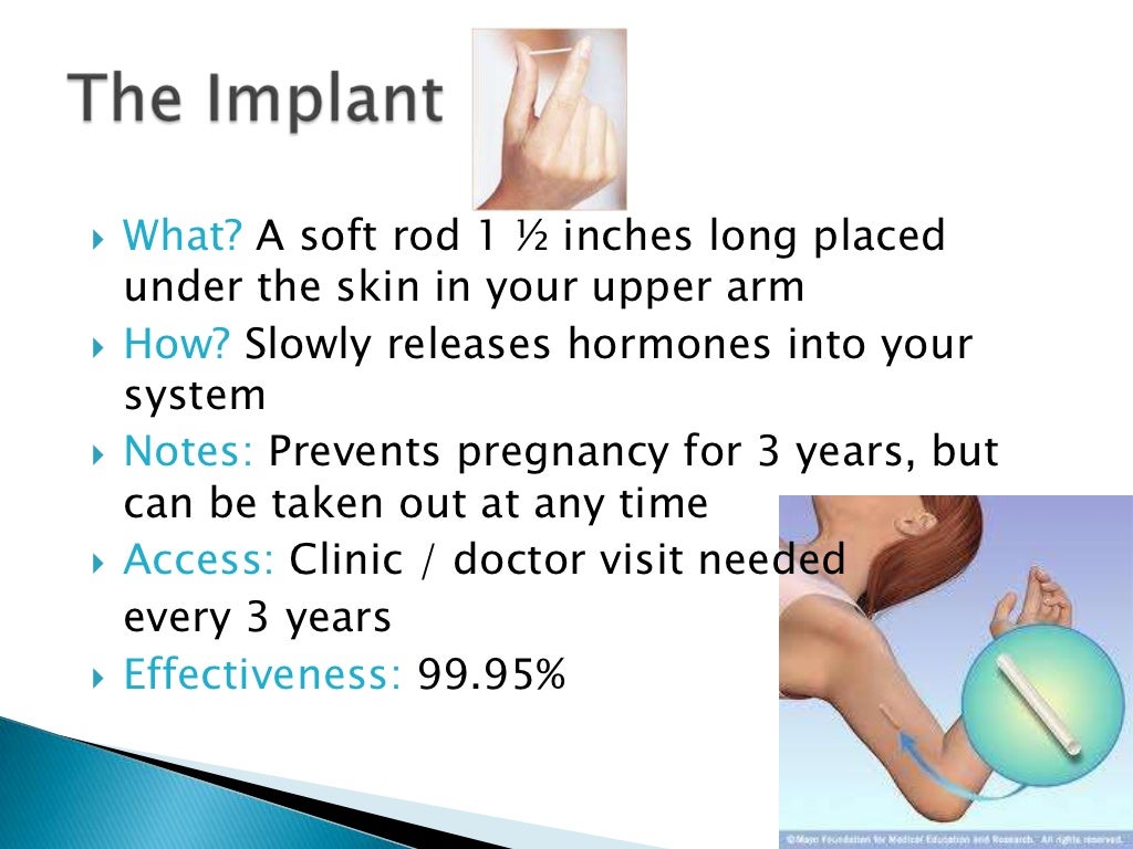 Contraception ppt