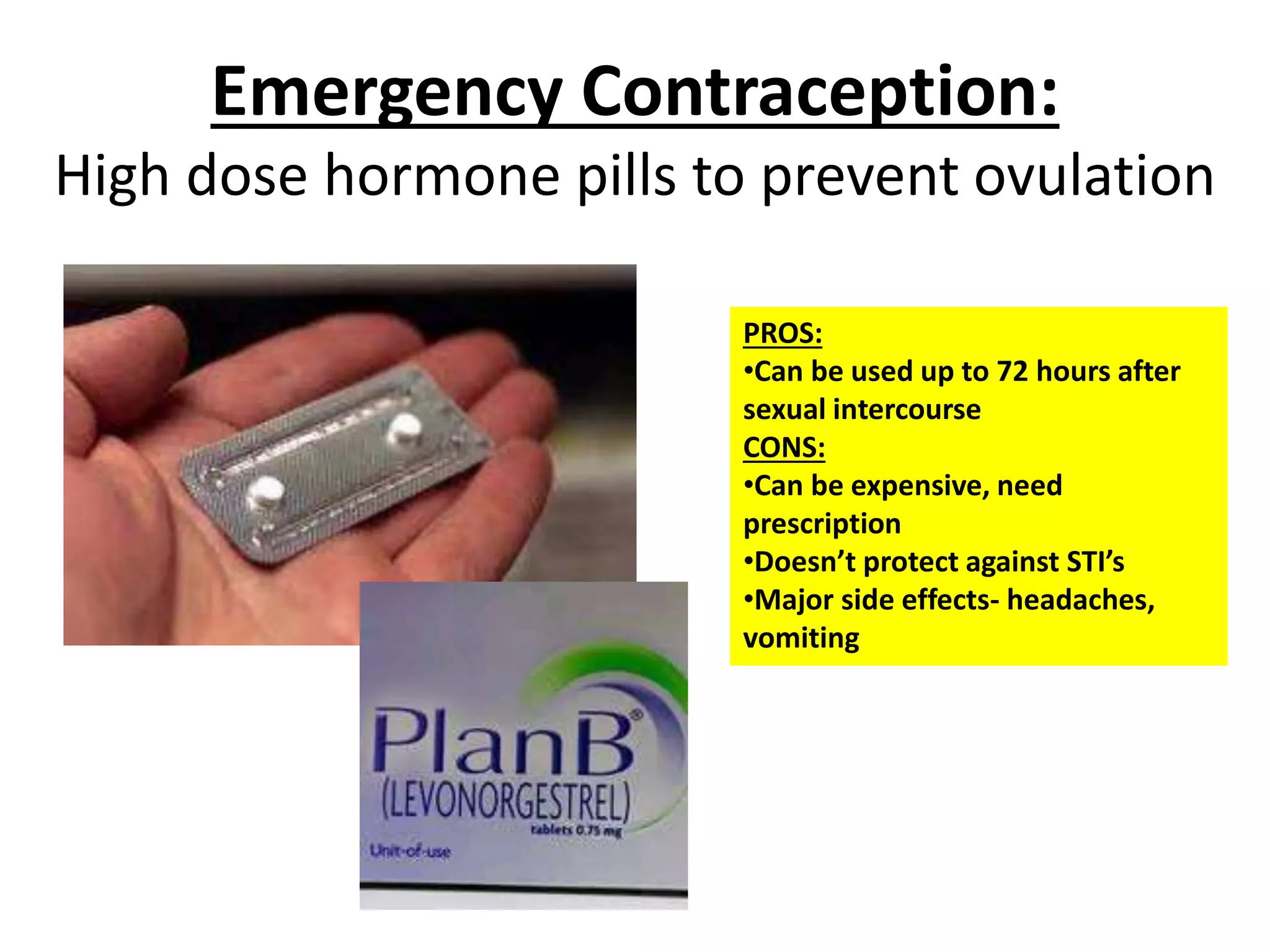 Contraceptive methods | PPTX