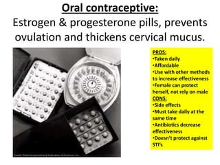 Contraceptive methods | PPTX