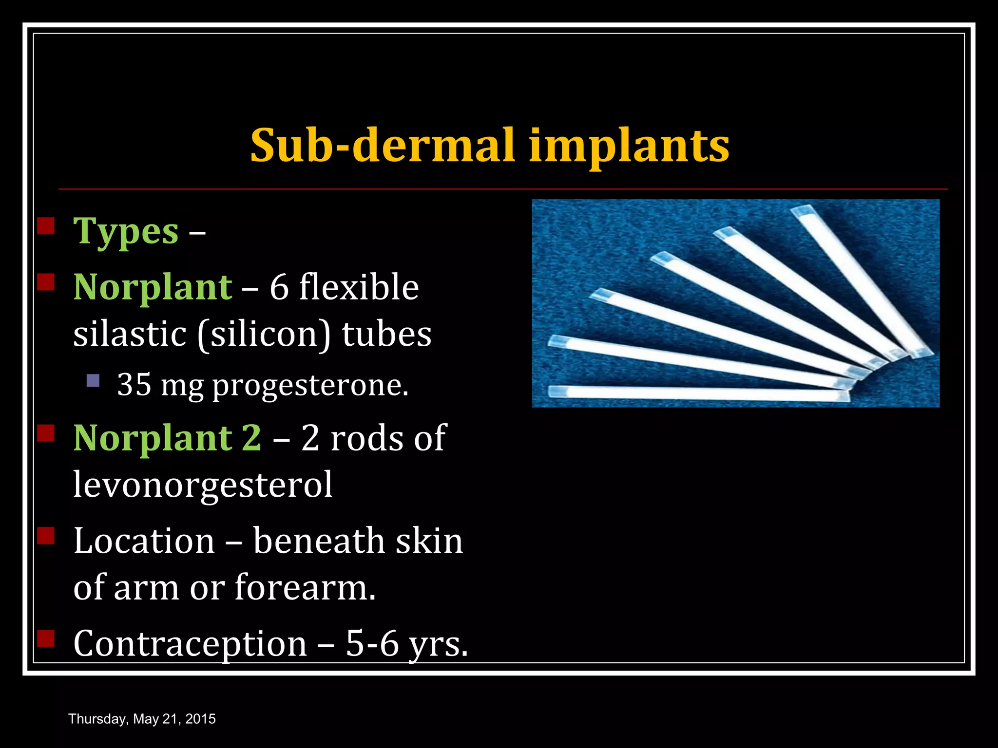 CONTRACEPTIVE METHODS | PPT