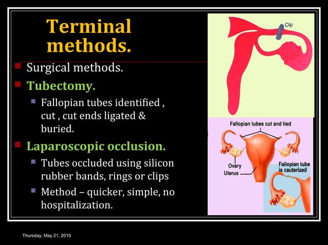 CONTRACEPTIVE METHODS | PPT