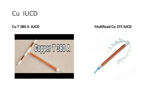 Contraceptive methods obstetric gynaecology | PPTX