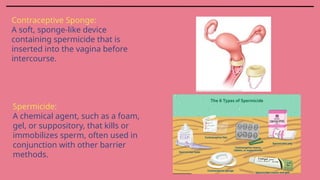 /CONTRACEPTIVE METHODS_CBSE_12th_BIOLOGY/ | PPTX
