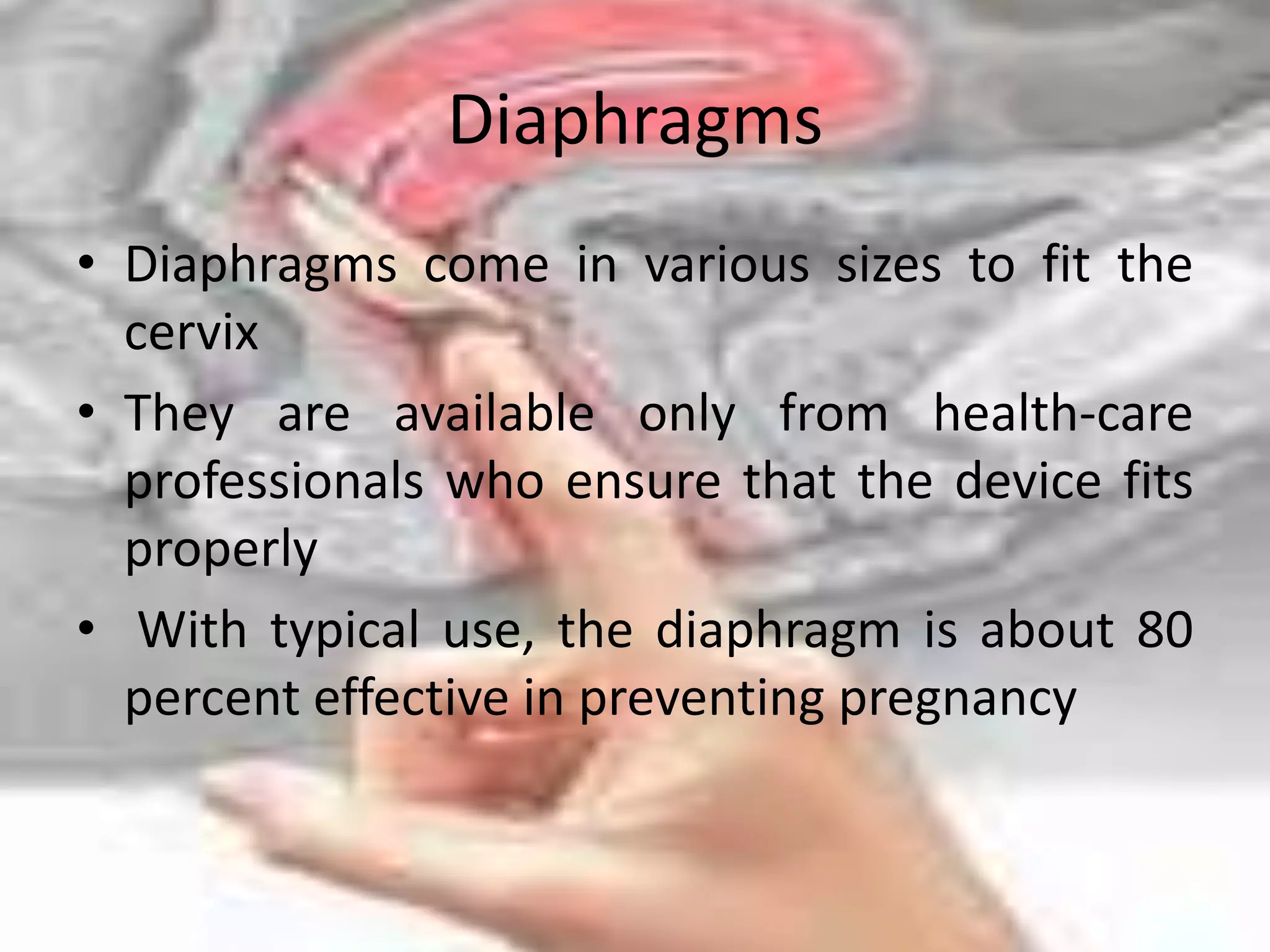 Contraceptives | PPTX