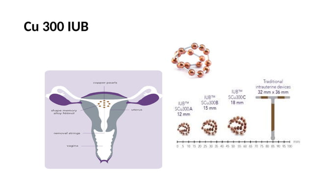 CONTRACEPTIVES newer - PPT recent advances | PPT